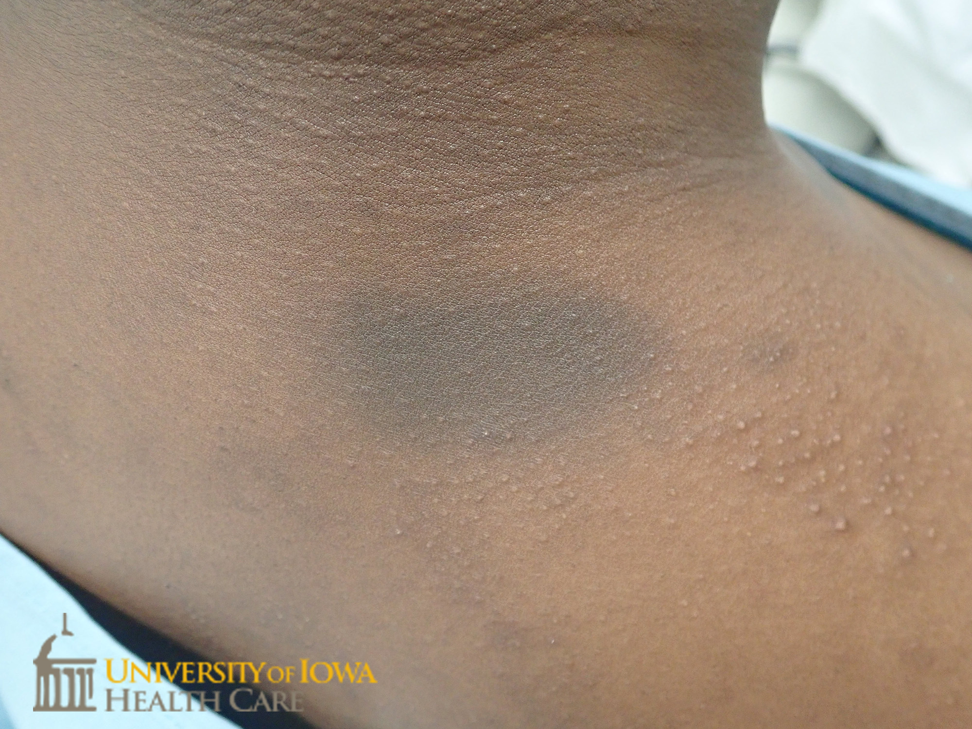 Dark gray ovoid patch on the back. (click images for higher resolution).