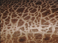 Dermatology Skin of Color Image Atlas