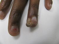 Dermatology Skin of Color Image Atlas