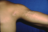 Dermatology Skin of Color Image Atlas